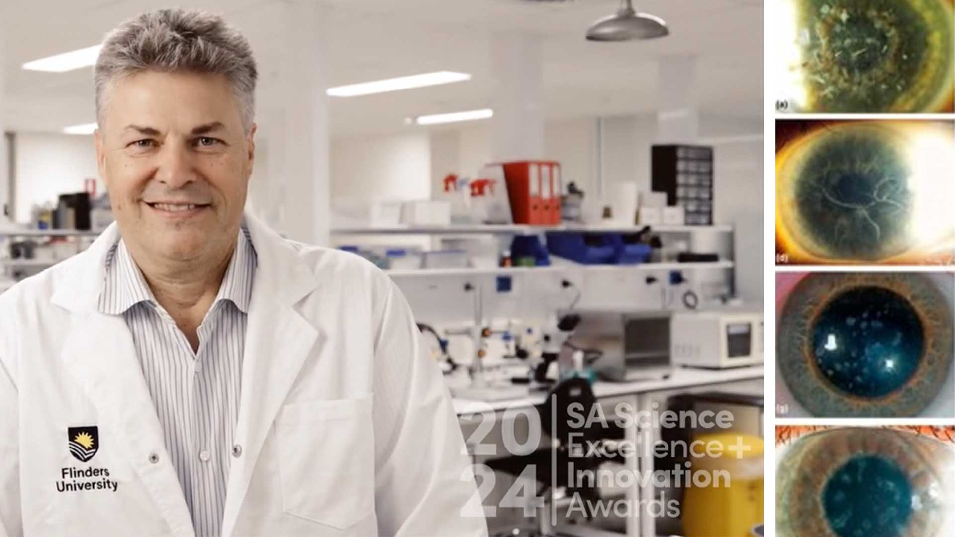 Professor Jamie Craig, South Australian 2024 Scientist of the Year, for ...